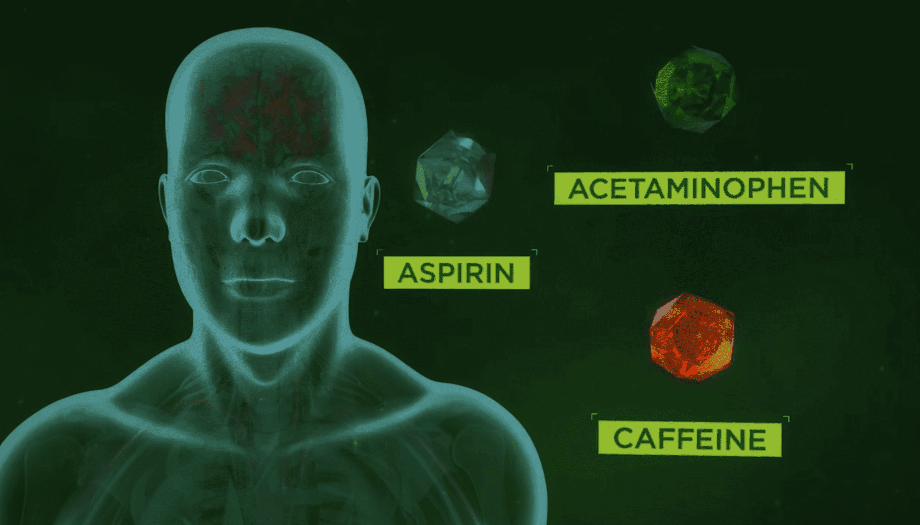 Excedrin: What's Happening When You Have a Migraine by Mass FX Media